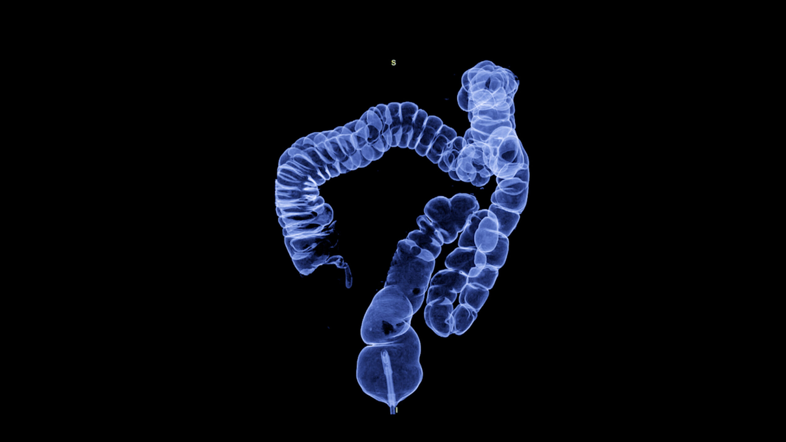 Colorectal Care for Adults: Age-Specific Screening and Risks - Not Mum ...